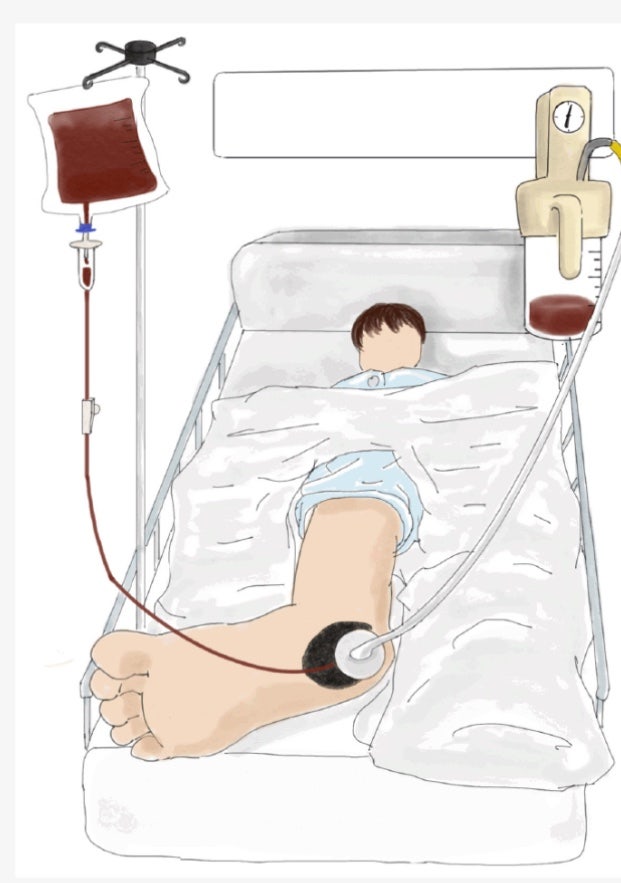 Curavac(큐라박)치료법에 대해 : 네이버 블로그