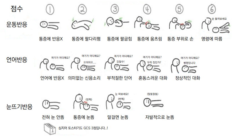 GCS 점수(Glasgow Coma Scale, GCS score)의 정의, 구성 및 예시 : 네이버 블로그