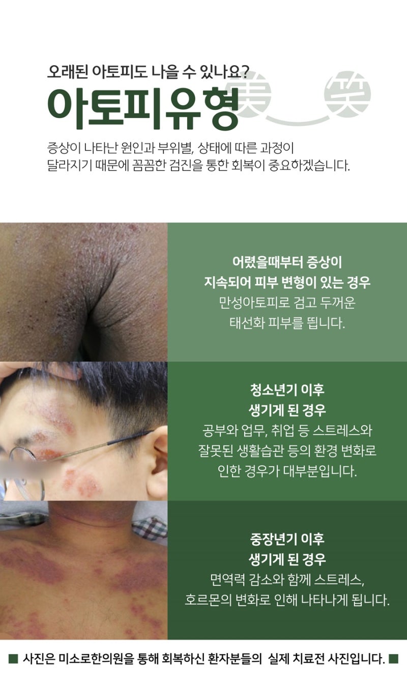 수원아토피치료 원하는 결과를 이루기 위해 : 네이버 블로그