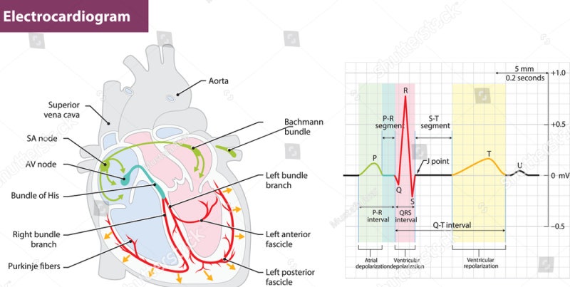 Junctional escape rhythm(방실접합부 리듬), Junctional rhythm, PJC, PSVT ...