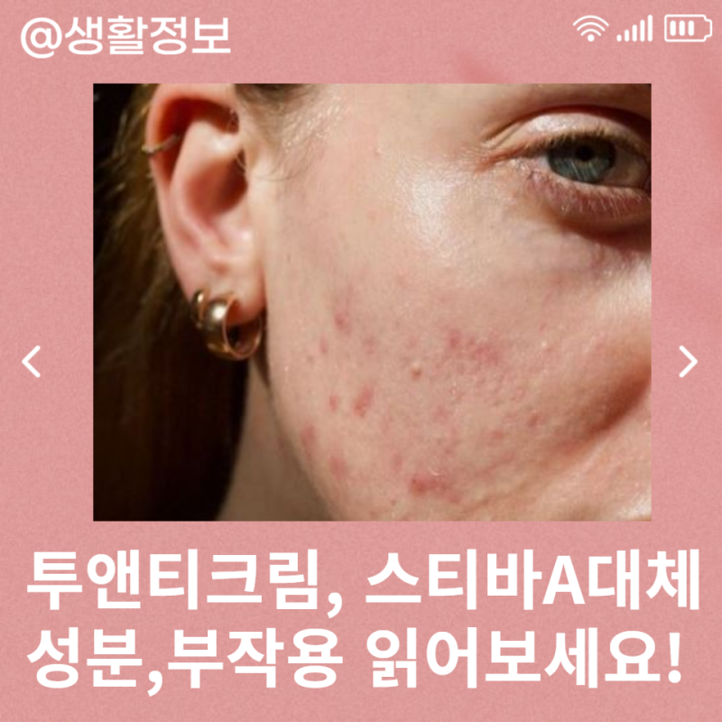 투앤티크림 처방 가격 약국 부작용까지 총정리 스티바a크림 단종 네이버 블로그