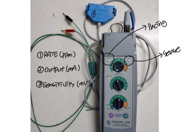 PM pacemaker : 인공심박동기, TPM (Temporary Pacemaker), PPM(Permanent PM), 시술 ...