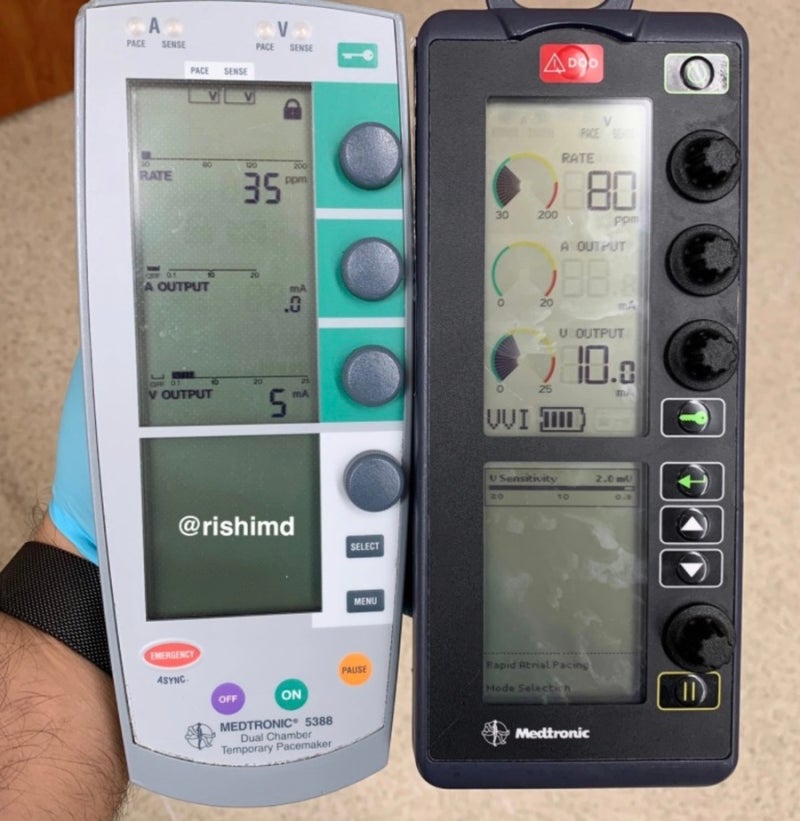 PM pacemaker : 인공심박동기, TPM (Temporary Pacemaker), PPM(Permanent PM), 시술 ...