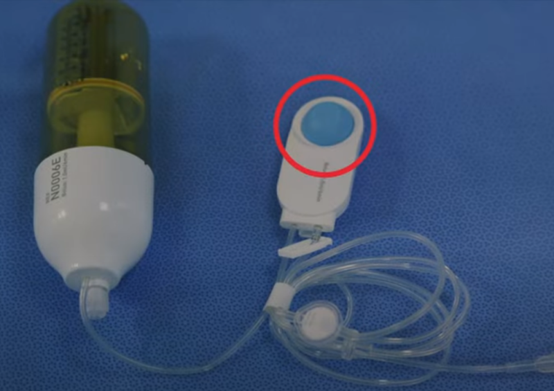 전신마취 수술 후 간호 (post op) & IV PCA, Inspirometer : 네이버 블로그