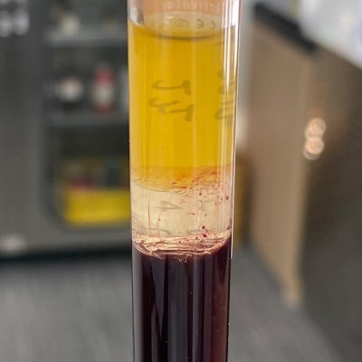 hemolysis, lipemic, Icteric 혈청 : 네이버 블로그