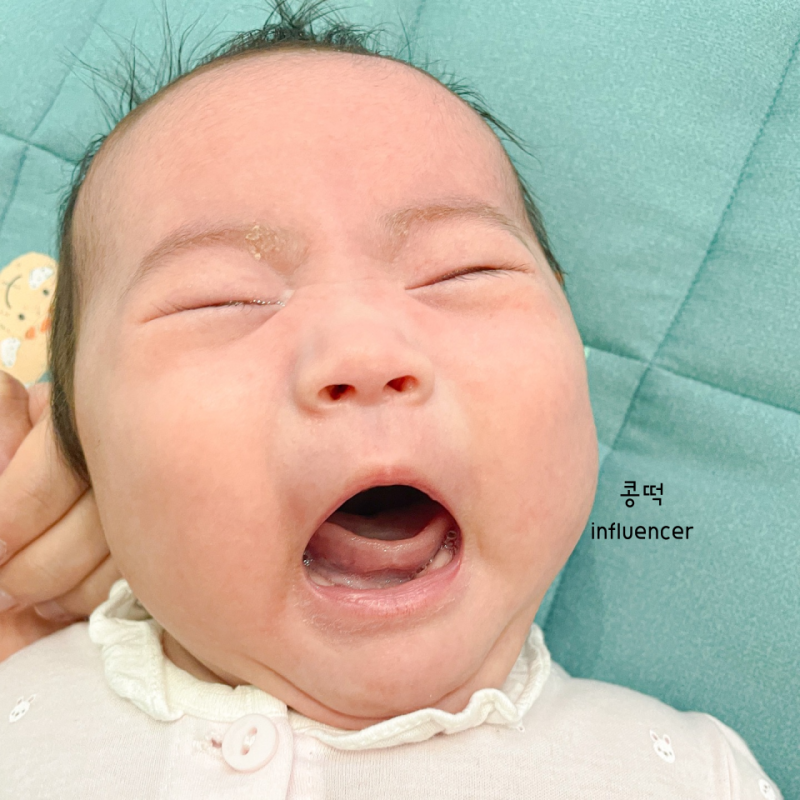 아기 낙상사고 침대에서 떨어졌어요 떨어짐 방지 방법 네이버 블로그
