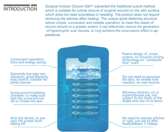Bifix (바이픽스) 의료용봉합유지기 : 네이버 블로그