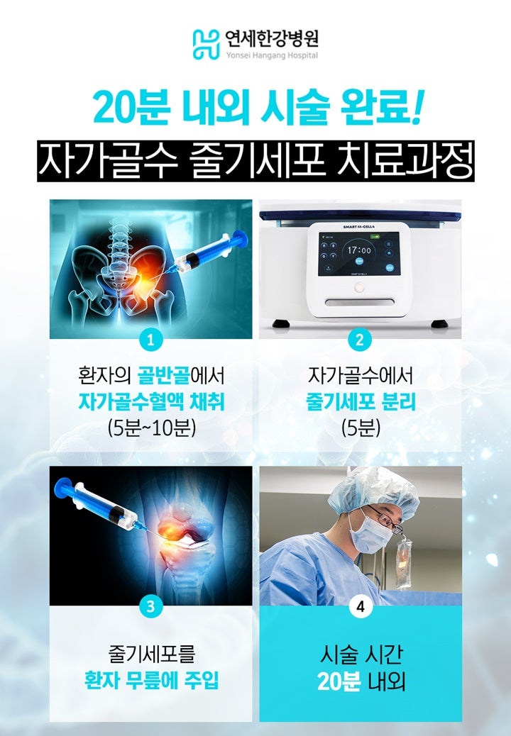 무릎 줄기세포 주사 1회 시술 후 2년 효과 정말일까 네이버 블로그