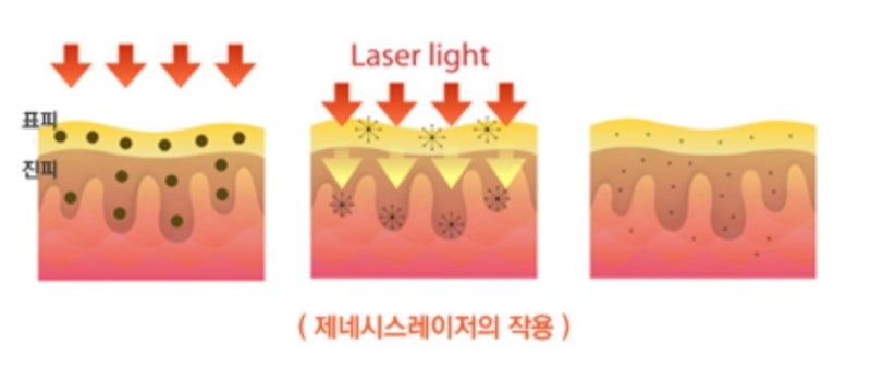 피부의 구조와 기능 2 표피 부속기 진피 피하지방 근막층 네이버 블로그