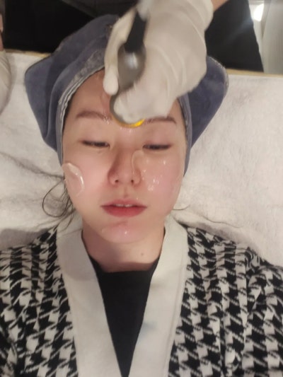 제네시스 레이저 토닝 5회차 시술 효과 주기 솔직 후기 네이버 블로그