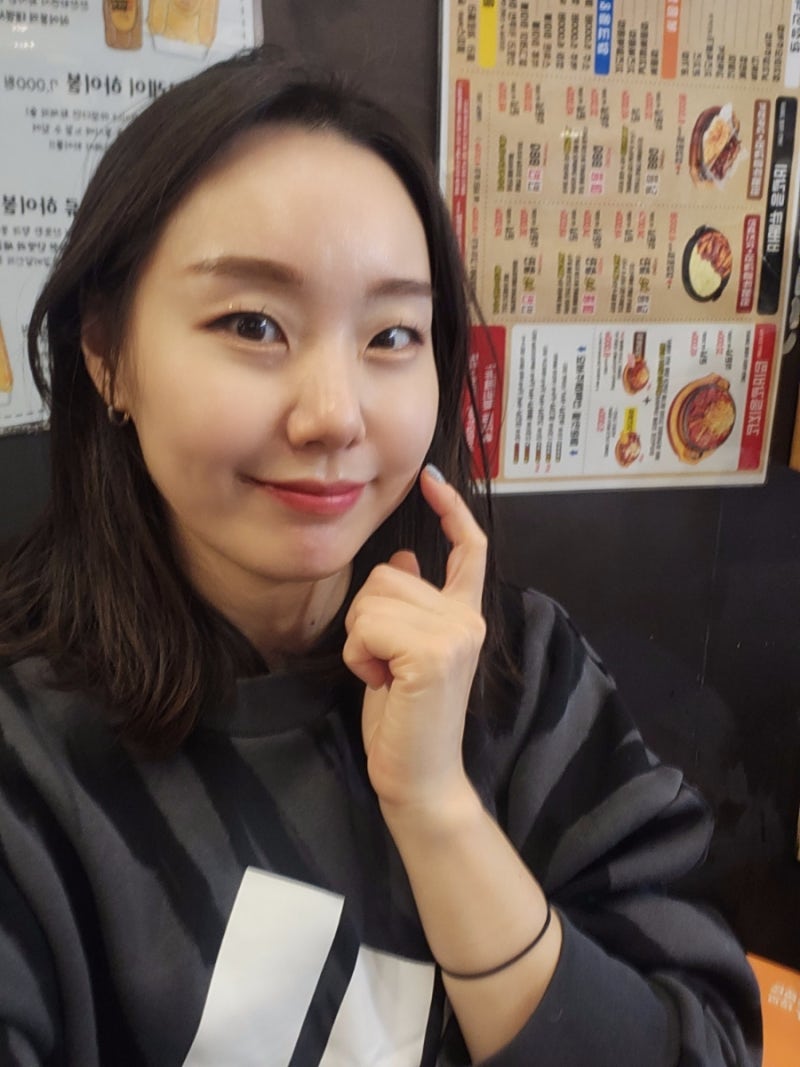 제네시스 레이저 토닝 5회차 시술 효과 주기 솔직 후기 네이버 블로그
