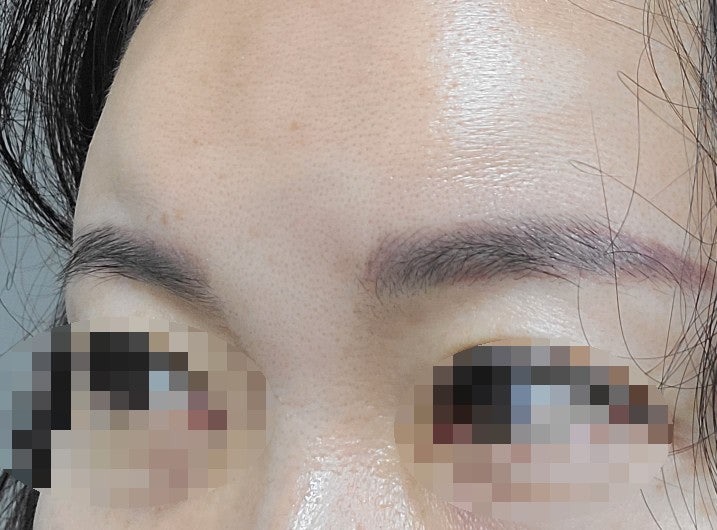 올리브영 미간주름패치 마르시끄 솔직 후기 네이버 블로그