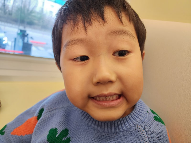 유아 아기 얼굴 백색비강진 백반증 원인 피부과 엑시머 치료 비용 네이버 블로그