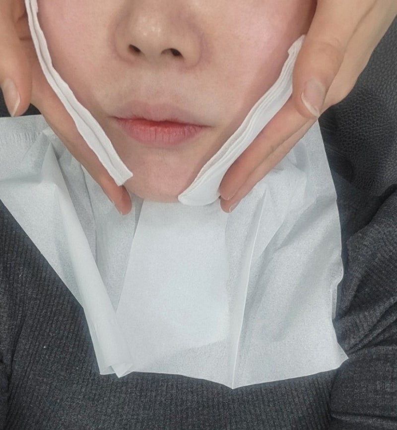 인하대역 피부과 온다리프팅 윤곽주사로 얼굴다이어트 후기 효과 네이버 블로그
