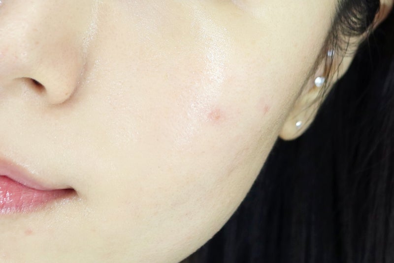 메디큐브 에이지알 부스터프로 1등 뷰티기기 디바이스 사용법에어샷 부스터 미세전류 더마샷 네이버 블로그