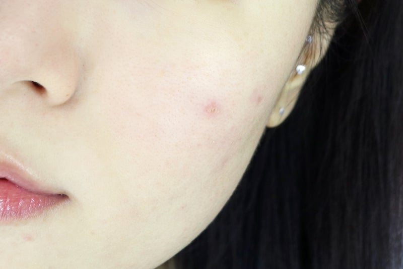 메디큐브 에이지알 부스터프로 1등 뷰티기기 디바이스 사용법에어샷 부스터 미세전류 더마샷 네이버 블로그