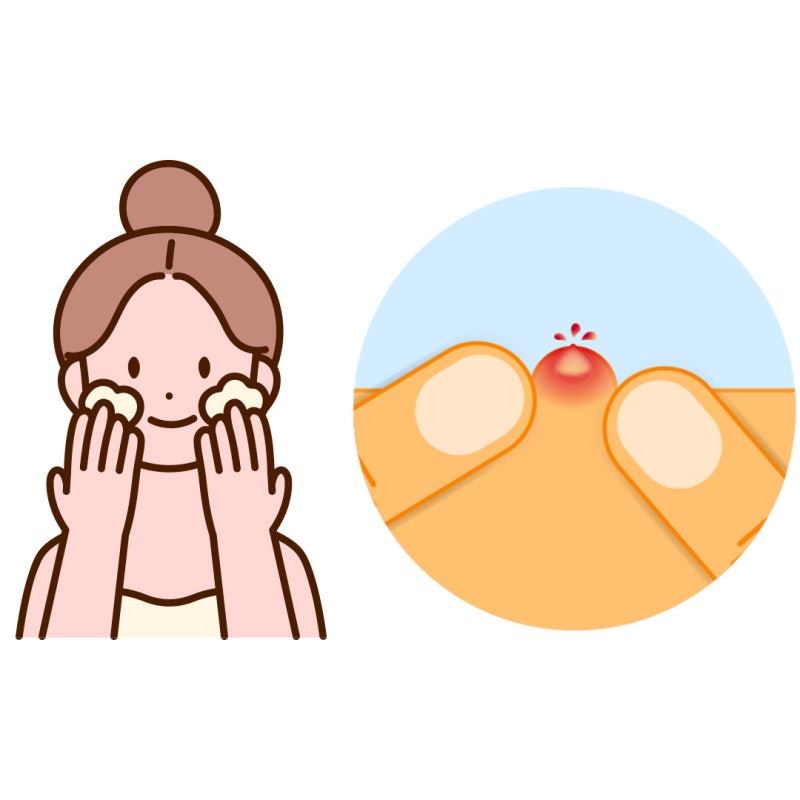 텍스파놀 연고 텍스판테놀 연고 효능 효과 텍스파놀 마데카솔 분말 비판텐 연고 네이버 블로그