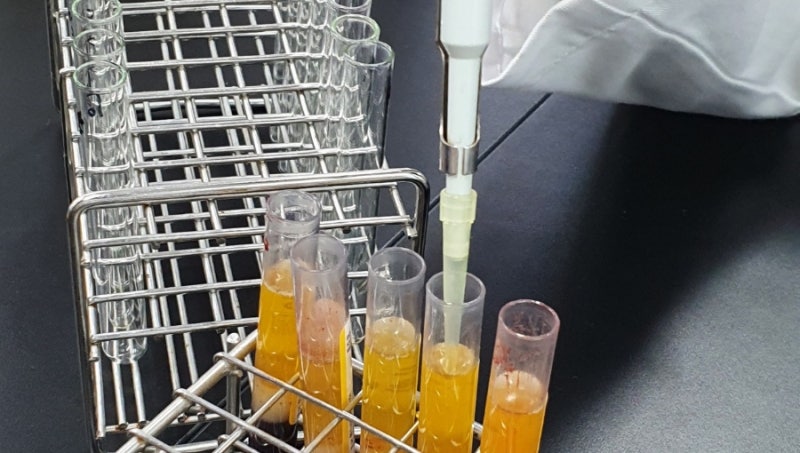 임상화학 검사실 부적합 검체 기준 : 네이버 블로그