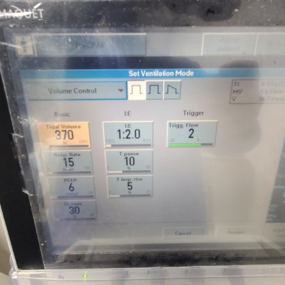 인공호흡기 Ventilator mode CMV와 SIMV 종류 및 차이점 : 네이버 블로그