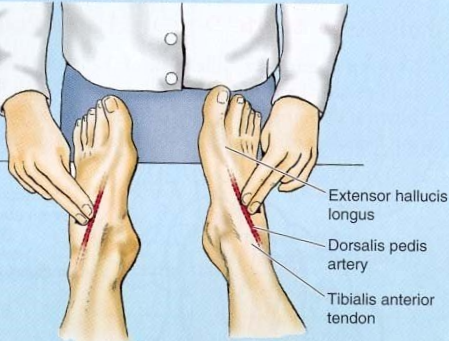 TFCA(Trans Femoral Cerebral Angiography) 뇌혈관조영술 검사 및 간호 : 네이버 블로그