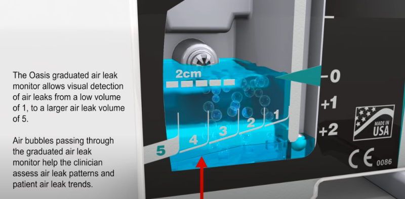 [중환자 모니터링] OASIS chest bottle : 네이버 블로그