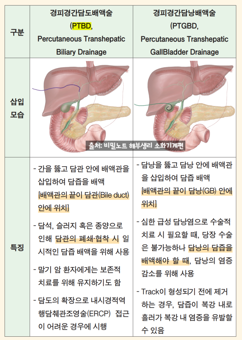 간 담도 배액관 종류 총정리ㅣ의학용어 PTBD, PTGBD, ENBD, ERBD 차이 : 네이버 블로그