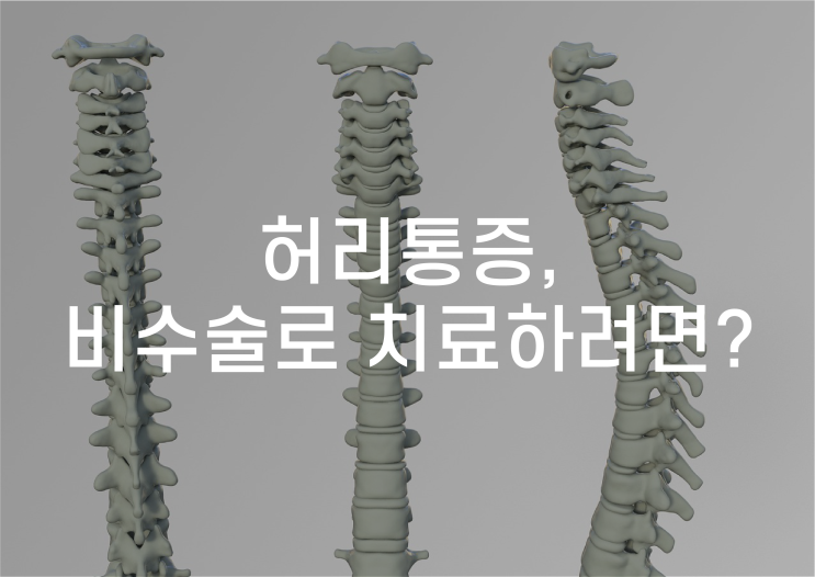 동탄허리통증 비수술 한방 치료로 회복하려면