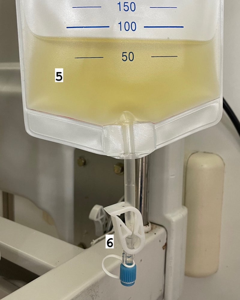 뇌실 외 배액(External Ventricular Drainage, EVD) : 네이버 블로그