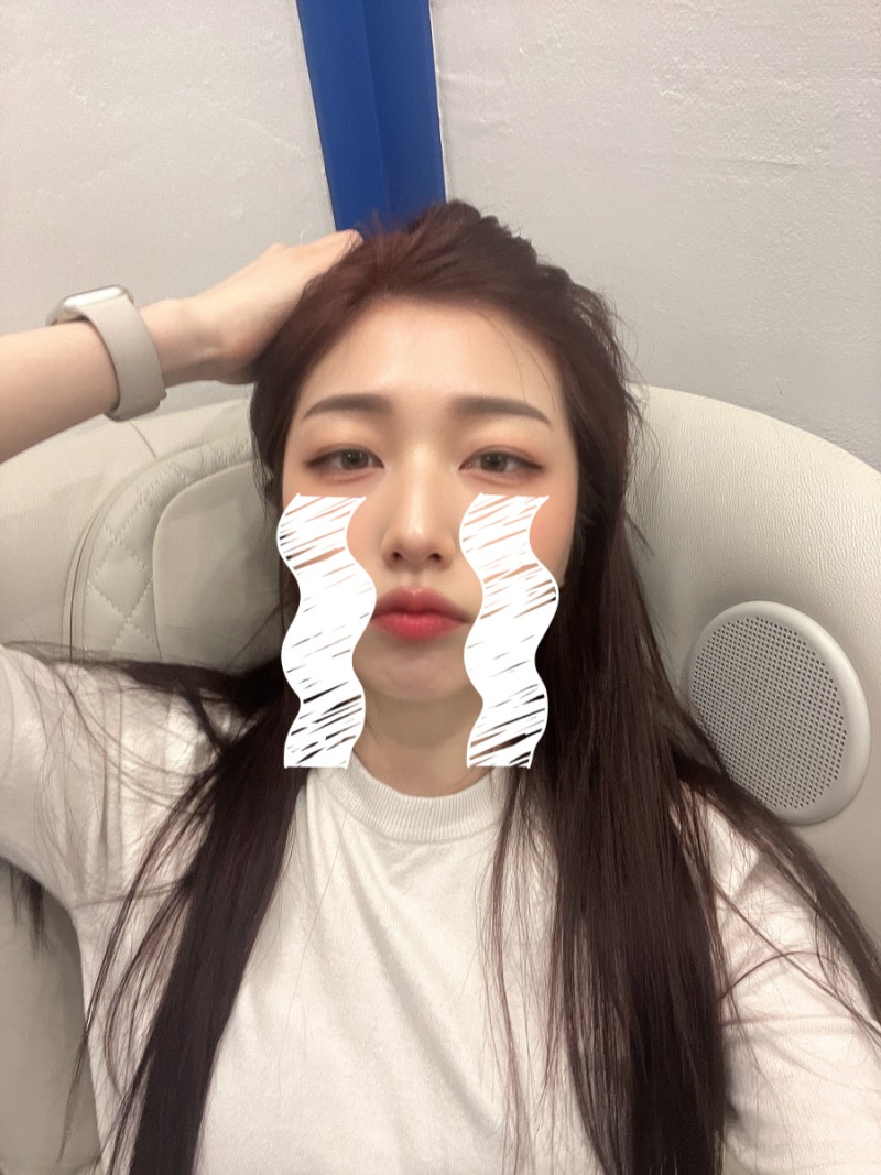 슈퍼젝션 블랙 강남피부관리 바른얼굴윤곽연구소 네이버 블로그