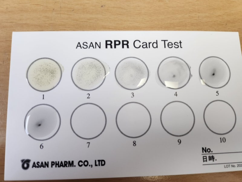 RPR 정량 검사방법 RPR titer와 매독검사의 종류 : 네이버 블로그