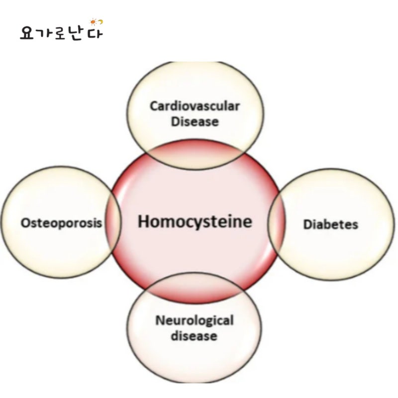 호모시스테인homocysteine이란 호모시스테인 역할 고호모시스테인혈증 호모시스테인 수치의 의미 고호모시스테인