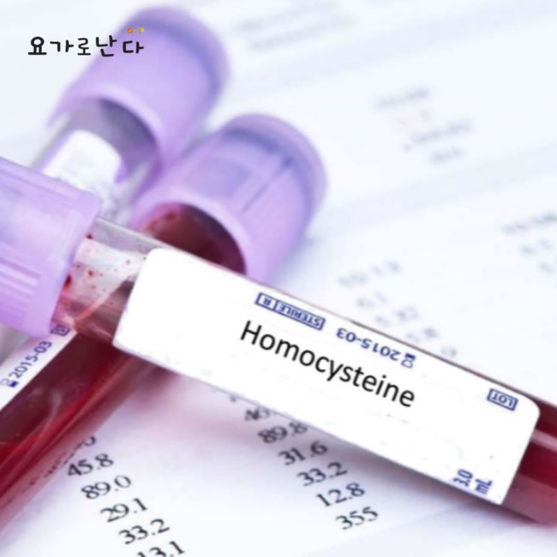 호모시스테인homocysteine이란 호모시스테인 역할 고호모시스테인혈증 호모시스테인 수치의 의미 고호모시스테인
