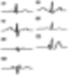 EKG해석 APC VPC A-fib VT VF asystole PEA 알아보기 : 네이버 블로그