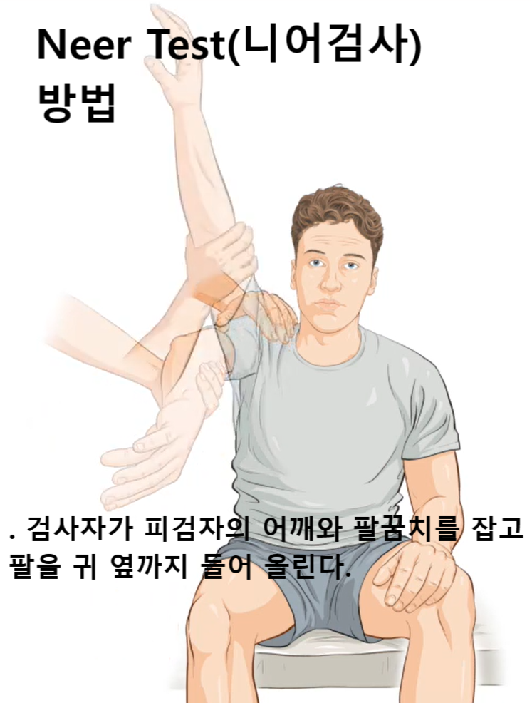 어깨충돌증후군 증상 및 원인 그리고 스페셜 테스트(Neer Test, Hawkins Kennedy Test) : 네이버 블로그