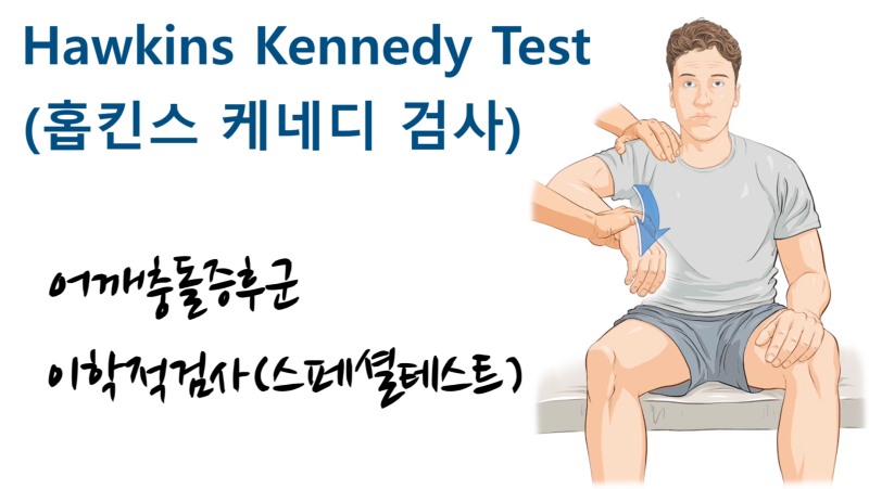 어깨충돌증후군 증상 및 원인 그리고 스페셜 테스트(Neer Test, Hawkins Kennedy Test) : 네이버 블로그