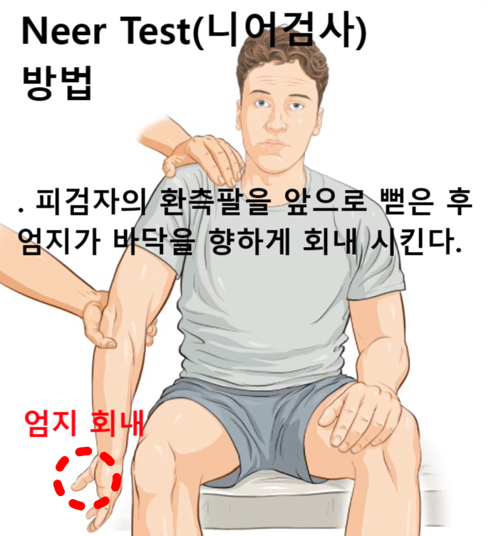 어깨충돌증후군 증상 및 원인 그리고 스페셜 테스트(Neer Test, Hawkins Kennedy Test) : 네이버 블로그