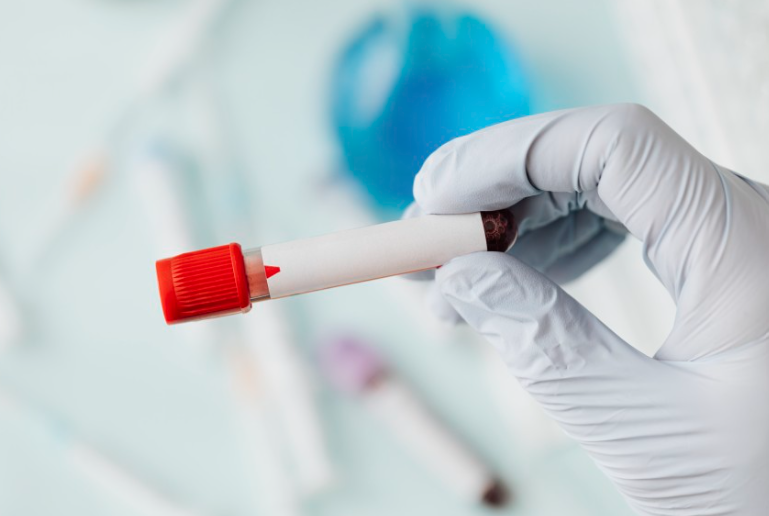 의학용어 DVT :: 심부정맥혈전증 정의 치료 주의사항 D-dimer 연관성 : 네이버 블로그