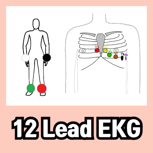 12 lead ekg 부착 방법, 검사 준비, 주의사항 : 네이버 블로그