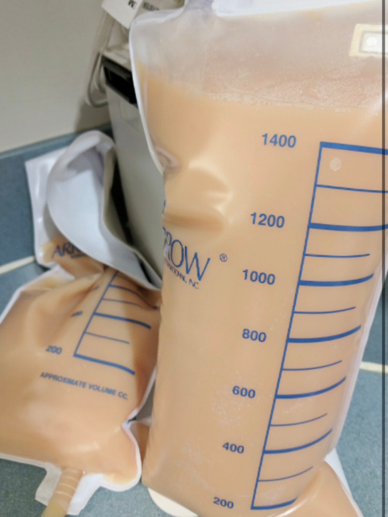 배액관의 종류와 양상의 모든 것 : Hemovac, Barovac (J-P) , Serous, Serosanguineous ...