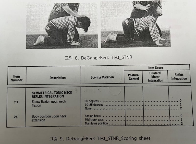 [감각통합기능 임상관찰]임상관찰 반사평가 방법 : STNR,ATNR,Righting reaction,쉴더상지신전검사,평형반응 ...