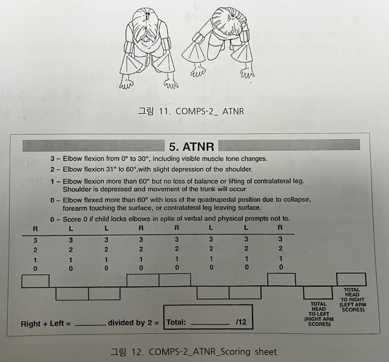 [감각통합기능 임상관찰]임상관찰 반사평가 방법 : STNR,ATNR,Righting reaction,쉴더상지신전검사,평형반응 ...