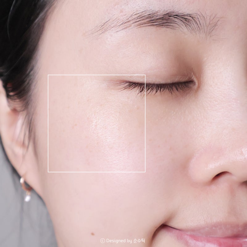 도미나크림 멜라논크림 부작용 사용법 가격 약국 색소침착 기미 잡티 크림 네이버 블로그