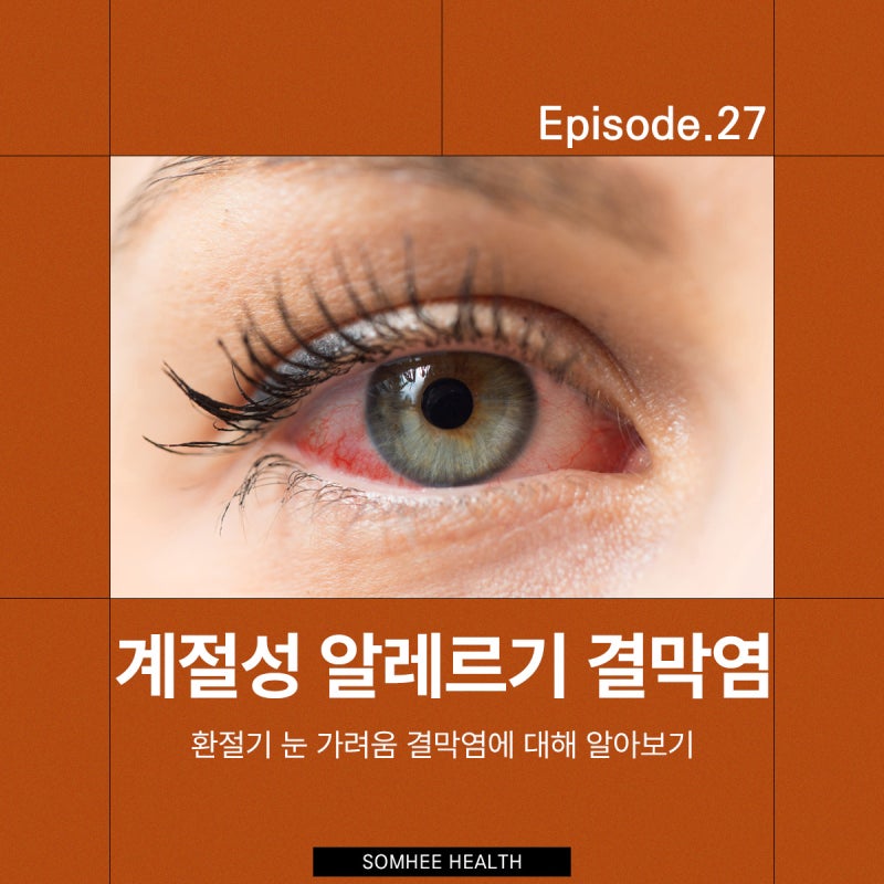 환절기 눈 가려움 계절성 알레르기 결막염 전염 약국 안약 추천 네이버 블로그