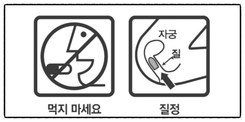질염 치료제 지노프로질정 가격 성분 사용방법 효과 및 부작용 네이버 블로그