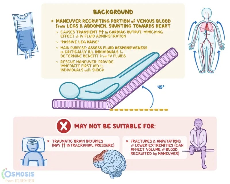 아나필락시스(Anaphylaxis)의 정의, 증상, 진단 및 치료 : 네이버 블로그
