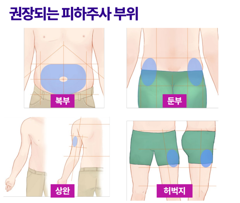 Iv Im Sc Id 정맥주사 근육주사 피하주사 피내주사 간호 수액용량계산 수액주입속도 주사부위 각도 주의사항 Skin Test