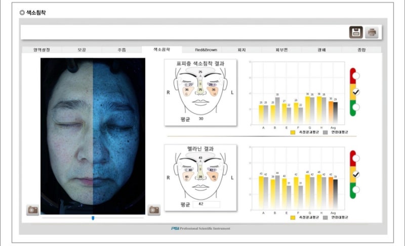 [피부진단기 소개] 마크뷰 Mark-Vu : 네이버 블로그