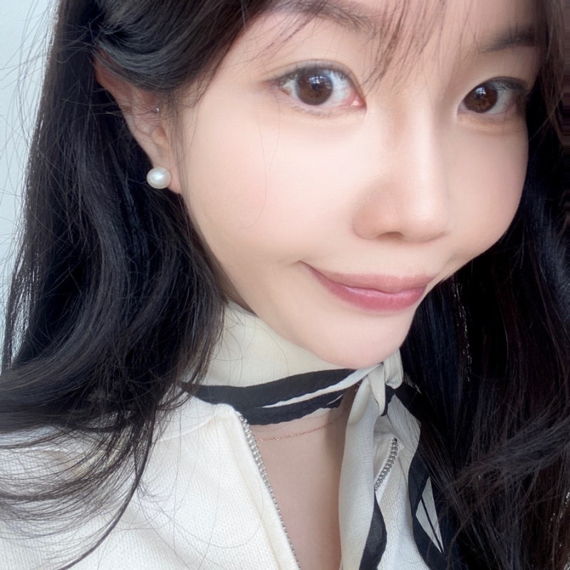 써마지 flx 600샷 한 달 경과 후기 : 가격 & 통증, 효과 시기 및 전후 (울쎄라 차이) : 네이버 블로그