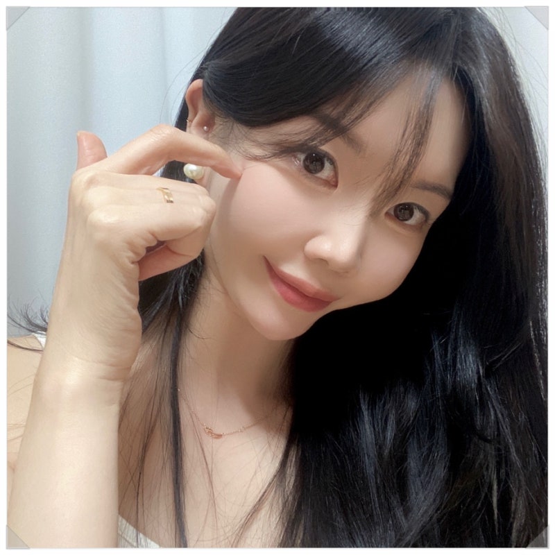 써마지 flx 600샷 한 달 경과 후기 : 가격 & 통증, 효과 시기 및 전후 (울쎄라 차이) : 네이버 블로그