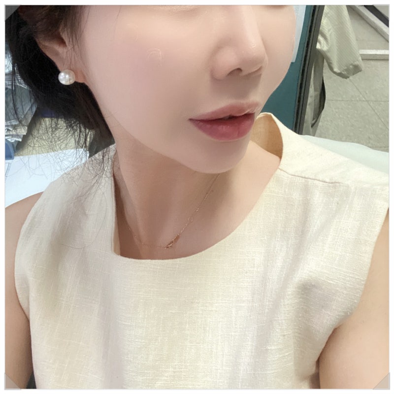 써마지 flx 600샷 한 달 경과 후기 : 가격 & 통증, 효과 시기 및 전후 (울쎄라 차이) : 네이버 블로그
